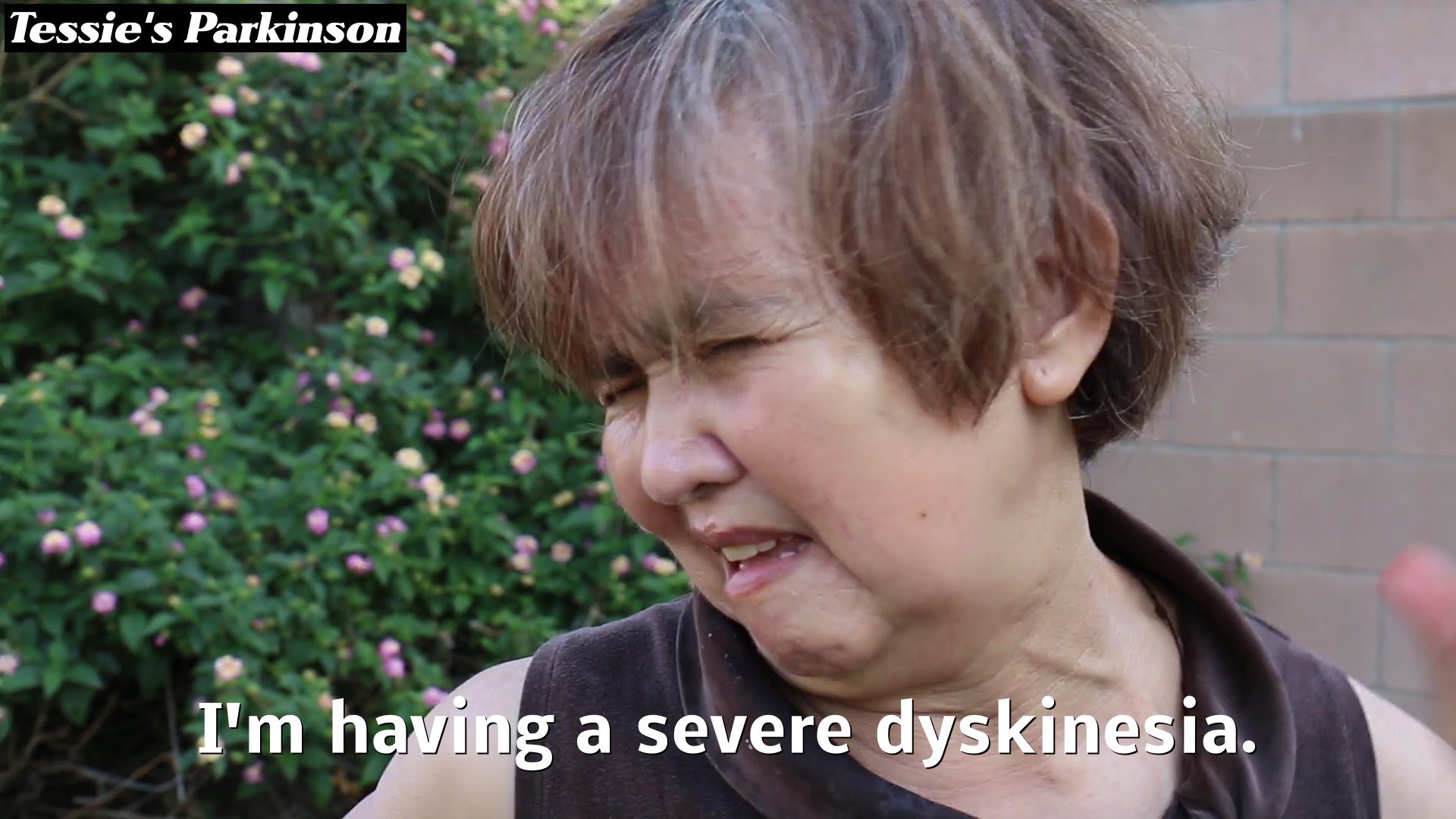 Demystifying Dyskinesias: By Dr. De Leon – defeatparkinsons